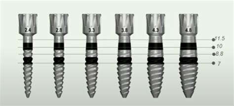 Ridge Split Technique Clinical Protocol For Narrow Ridges [guide For