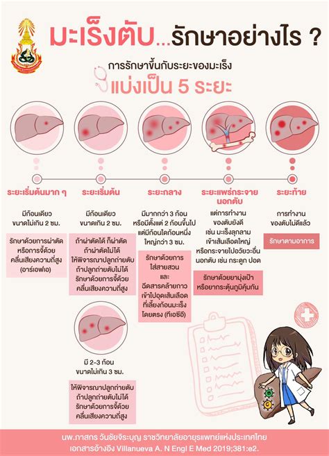 การรักษามะเร็งตับ เป็น มะเร็งที่ 1 มะเร็ง 2 โรค เพราะว่า บางคน เป็น มะเร็ง ตับแข็ง