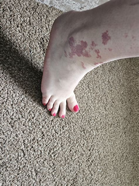 Got A Long Full Day On My Feet Today 👣 R Feetfanatic