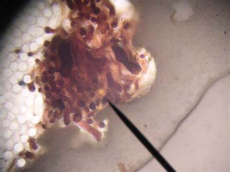 Transmission Light Micrograph Of Thread In Cross Section 10x