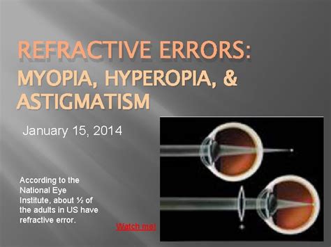 Refractive Errors Myopia Hyperopia Astigmatism January 15 2014