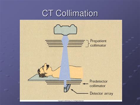 What Is Beam Collimation In Ct Scan At Eloise Rameriz Blog