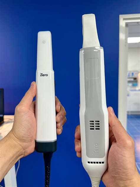 Itero Lumina Intraoral Scanner An In Depth Overview