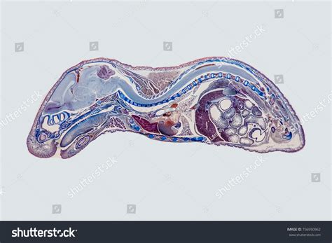 Mouse Spleen：超过 12 张免版税可许可的库存照片 Shutterstock