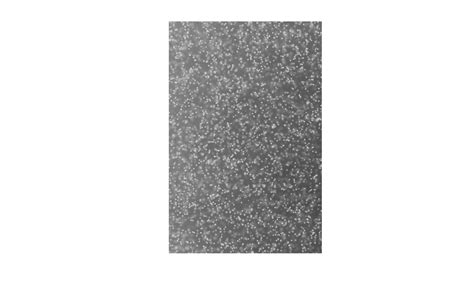 Particles Object Detection Model By Particletracking