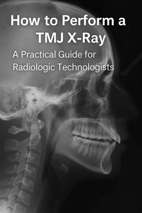 How To Perform A Tmj X Ray A Practical Guide For Radiologic Technologists