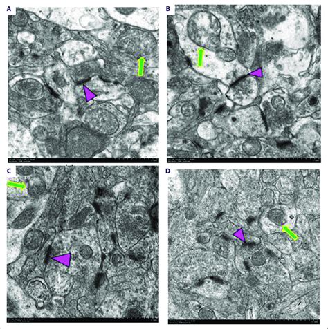 Mitochondria And Synapses ¯ In The Nucleus Accumbens Of Each Group Download Scientific