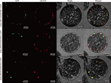 Colocalization Analysis Of Three Potato Csy Proteins With Mitochondria