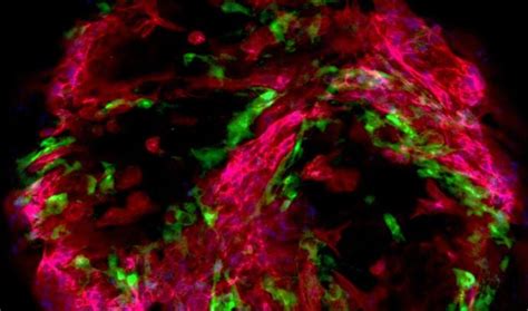 Dr Shabeer Nellikode On Linkedin Israel Unveils Miniature Human Heart