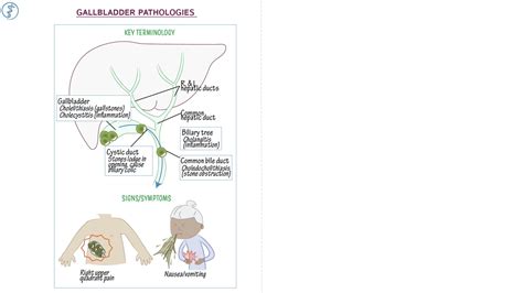 Clinical Pathology Gallbladder Pathologies Overview Ditki Medical