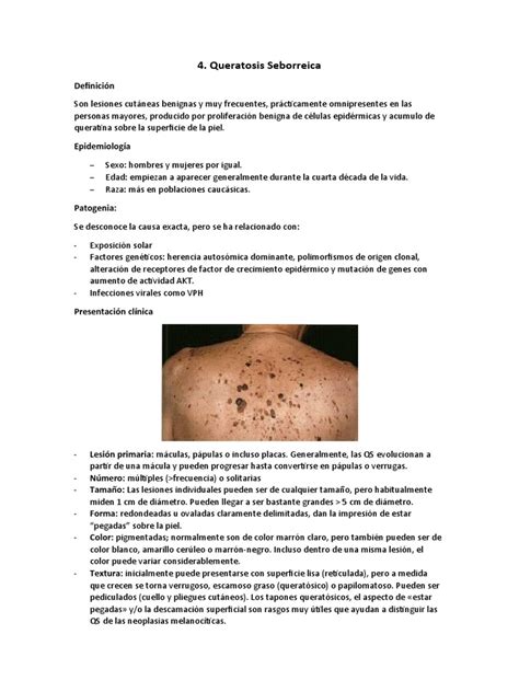 Queratosis Seborreica Causas Y Tratamiento Pdf Piel Color