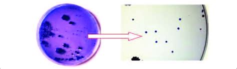 Streptococcus Mutans Colonies On Mitis Salivarius Bacitracin Agar Download Scientific Diagram