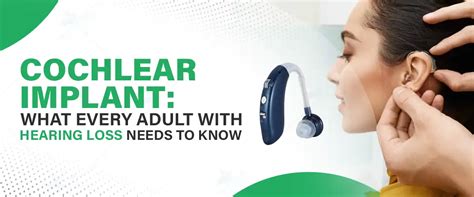 Cochlear Implant What Every Adult With Hearing Loss Needs To Know