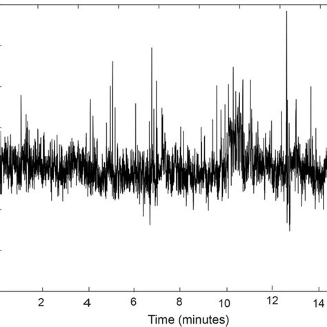 Mean And Normal Range Of Iop For Each Age Group And Gender Download Table