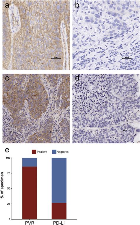 Results Of Immunohistochemical Staining For Pvr And Pd L1 Download Scientific Diagram