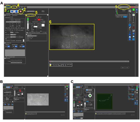Video Microscopía De Fluorescencia De Tres Fotones De Tejido Profundo En Cerebro Intacto De