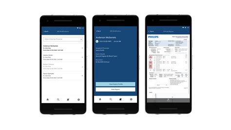 If Design Philips Ecg Reports App