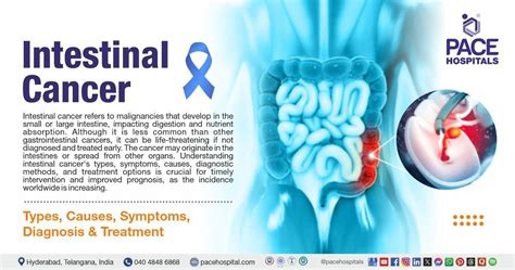 Intestinal Cancer Symptoms Causes Diagnosis And Treatment
