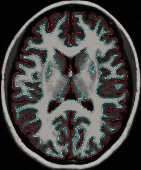 Segmentation Of The Cortex In A Surface Mesh Form The Inner Surface Download Scientific