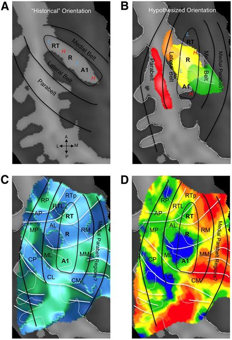 Hypothesized Positions Of Auditory Cortical Regions Coincide With Download Scientific Diagram