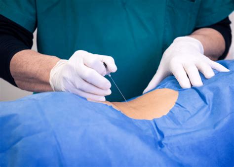 Measuring The Opening Pressure In Lumbar Puncture
