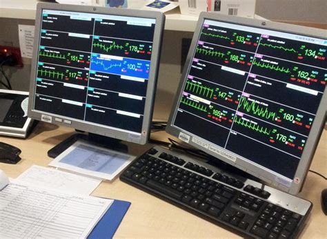 New Central Monitoring System Newborn Intensive Care Foundation