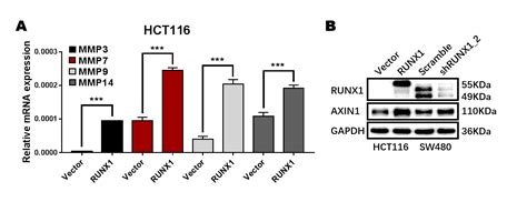 Runx1 Promotes Tumour Metastasis By Activating The Wntβ Catenin