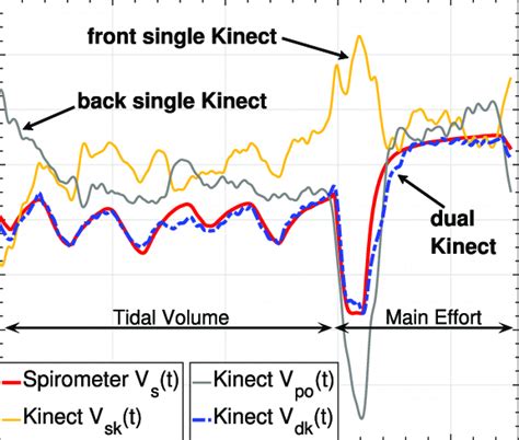 Comparing Fvc A And Svc B Volume Time Curves Of Dual Kinect V Dk Download Scientific