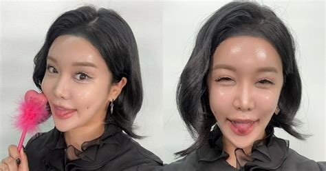 부캐 부자 랄랄 성형외과 상담 하루 2000명 돈방석 앉았다