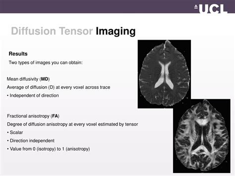 Ppt Diffusion Tensor Imaging Powerpoint Presentation Free Download