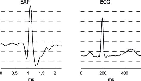 Example Of Using Ct Sampling For Eap And Ecg Representation Showing A