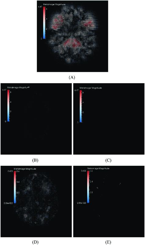 The Combined Deformations By Three Methods A Diffeomorphic Demons Download Scientific