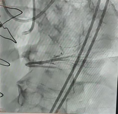 Shaik Masood Mohiddin On Linkedin Aster Dr Dr Biomime Biomime Hornet Ikazuchi