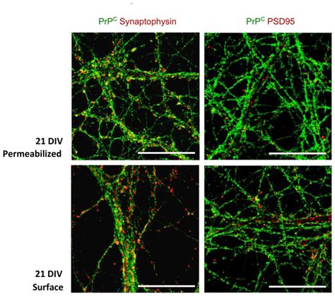 Prp C Co Immunolabeling With Synaptophysin Left And Psd95 Right