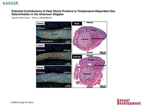 Potential Contributions Of Heat Shock Proteins To Temperature Dependent Sex Determination In The