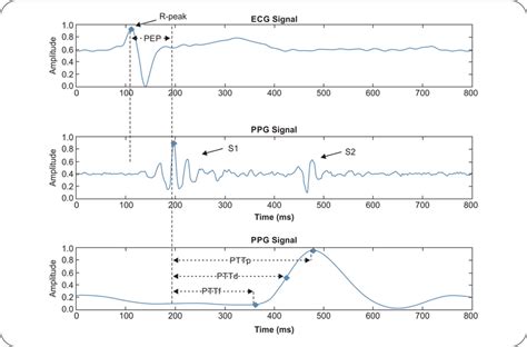 Ecg And Ppg First And Third Waveform Pat Pep Ptt Pcg And Ppg Download Scientific