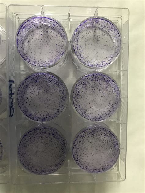 59 Questions With Answers In Colony Forming Units Assay Scientific Method