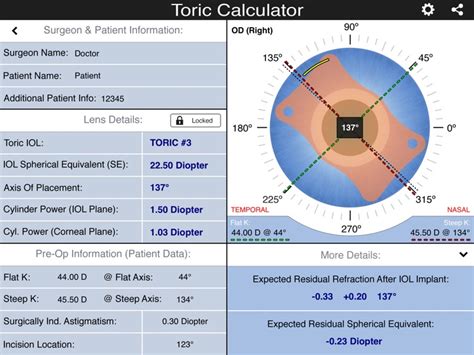 Iol Toric Calculator By Evandro Souza
