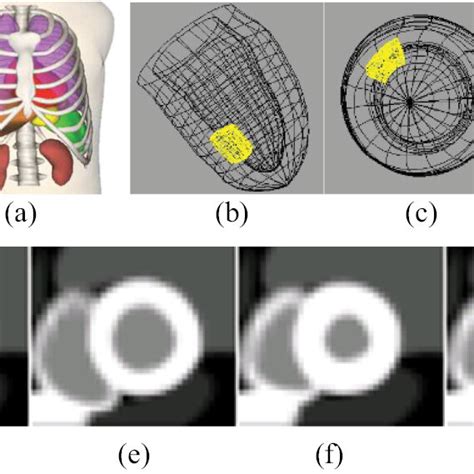 4d Ncat Model With A Beating Heart Anterior View Of The 4d Ncat