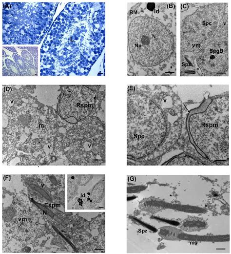 Figure 5 From Ultrastructural Analysis Of Large Japanese Field Mouse Apodemus Speciosus Testes