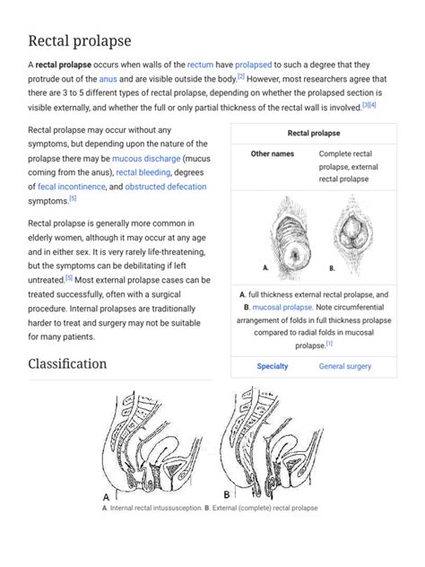 Understanding Rectal Prolapse Types Pdf Rectum Pelvis