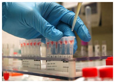 The Mystery Of Human Blood Types Science Technology Sott Net