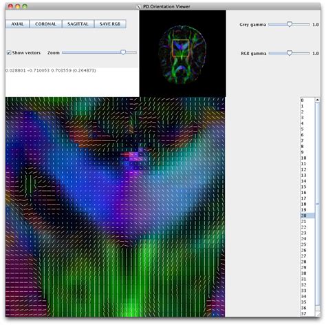 Dti Quality Control Part 2 Tensor Fitting Diffusion Imaging