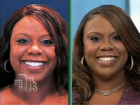 Now You Can Have Dimples Like Kelly Ripa Ahb
