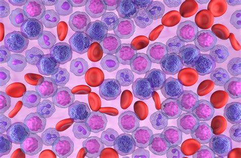 Revumenib Yields Meaningful Benefit In Npm1 Mutated Acute Myeloid Leukemia