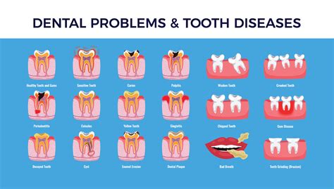 What Are The Two Most Common Dental Diseases Martlabpro