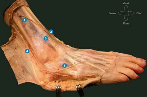 Anatomy Of Superficial Peroneal Nerve And Sural Nerve In Anterolateral