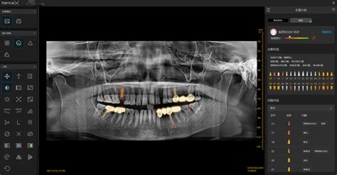 关于我们 牙医管家口腔管理软件