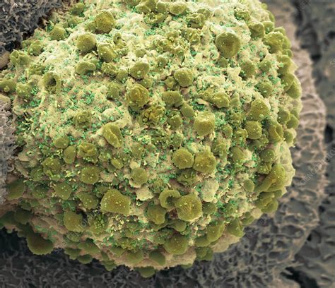 Sars Cov 2 Delta Variant Sem Stock Image C0536702 Science Photo Library