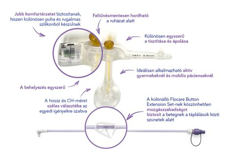 Nutricia Flocare® Button Set Nutriciamedical Hu